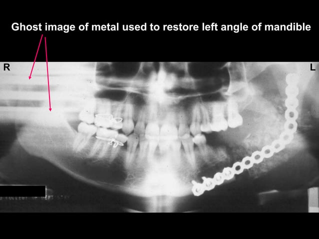 Self study-pan-anatomy | PPTX