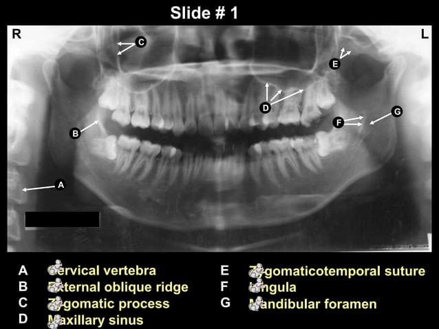 Self study-pan-anatomy | PPTX