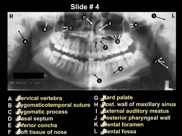 Self study-pan-anatomy | PPTX