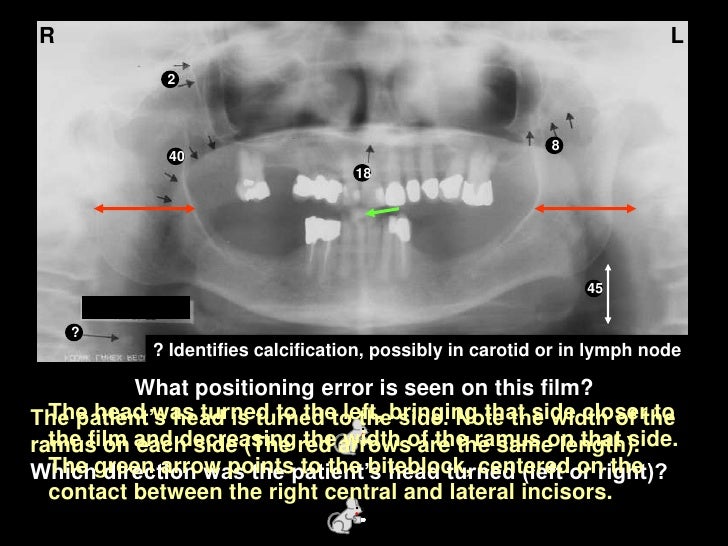 Pan- Definition Anatomy at Chad Frierson blog