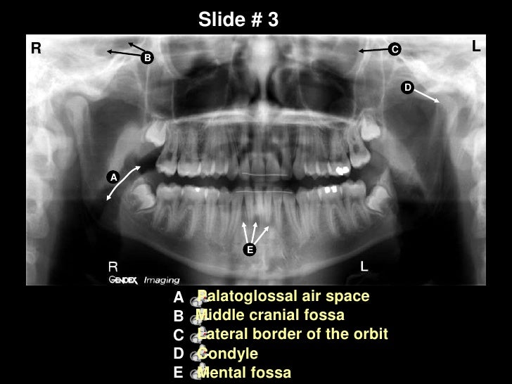 Self study-pan-anatomy