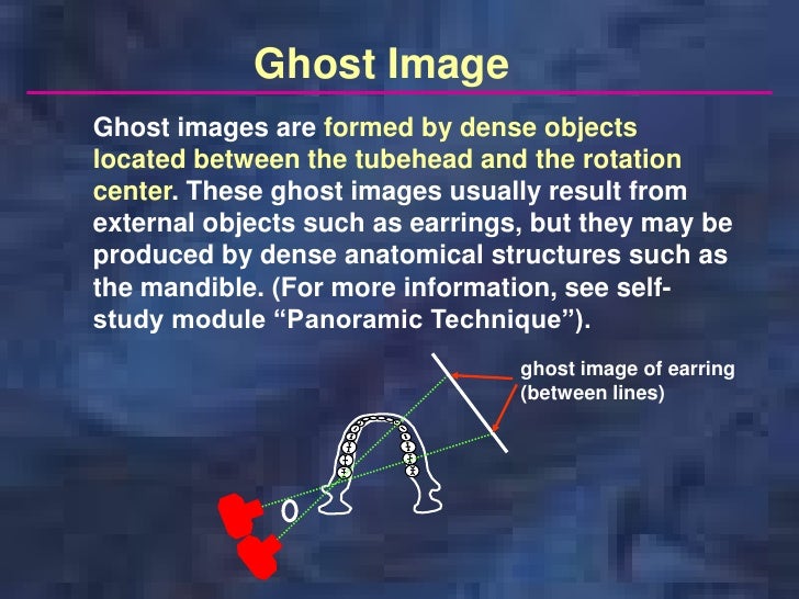 Self study-pan-anatomy