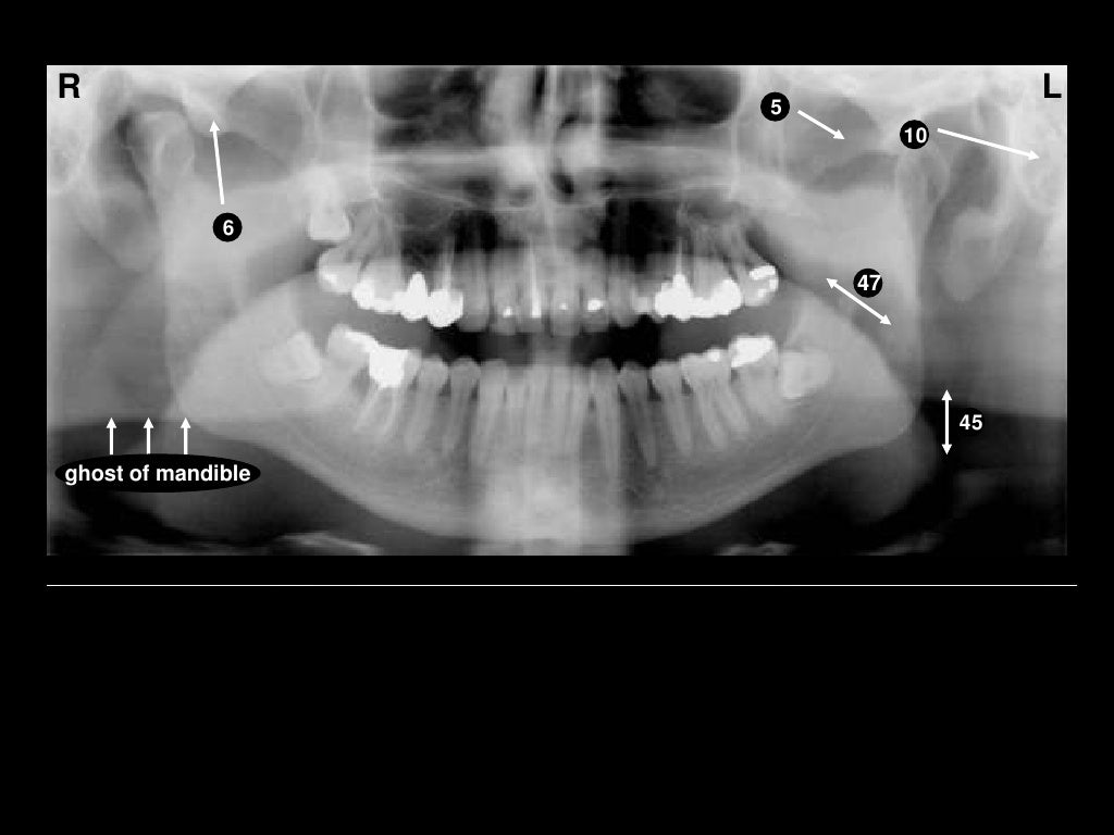 Pan- Definition Anatomy at Chad Frierson blog