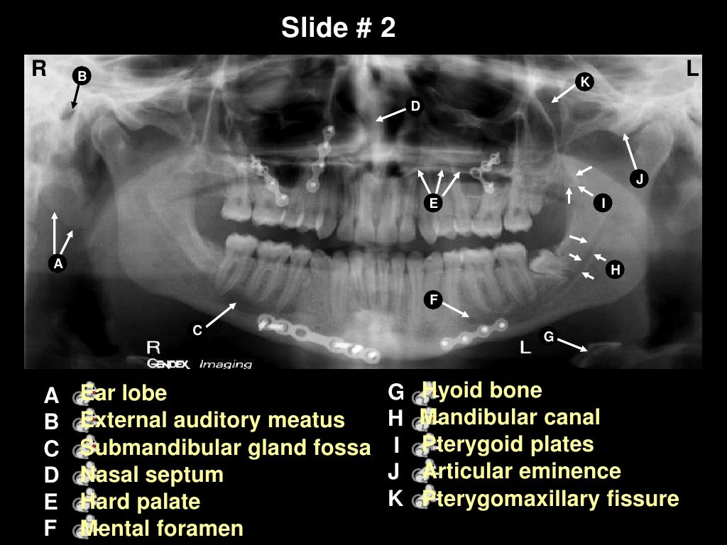 Self study-pan-anatomy