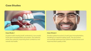 odontoplasty and transplantation of tooth germs | PPTX