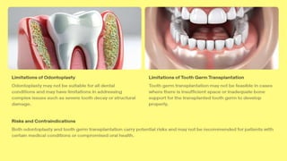 odontoplasty and transplantation of tooth germs | PPTX