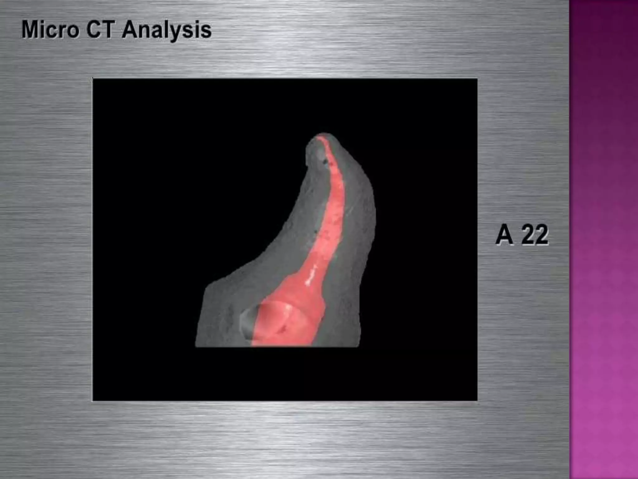 Self adjusting file | PPT
