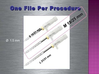 Self adjusting file | PPT