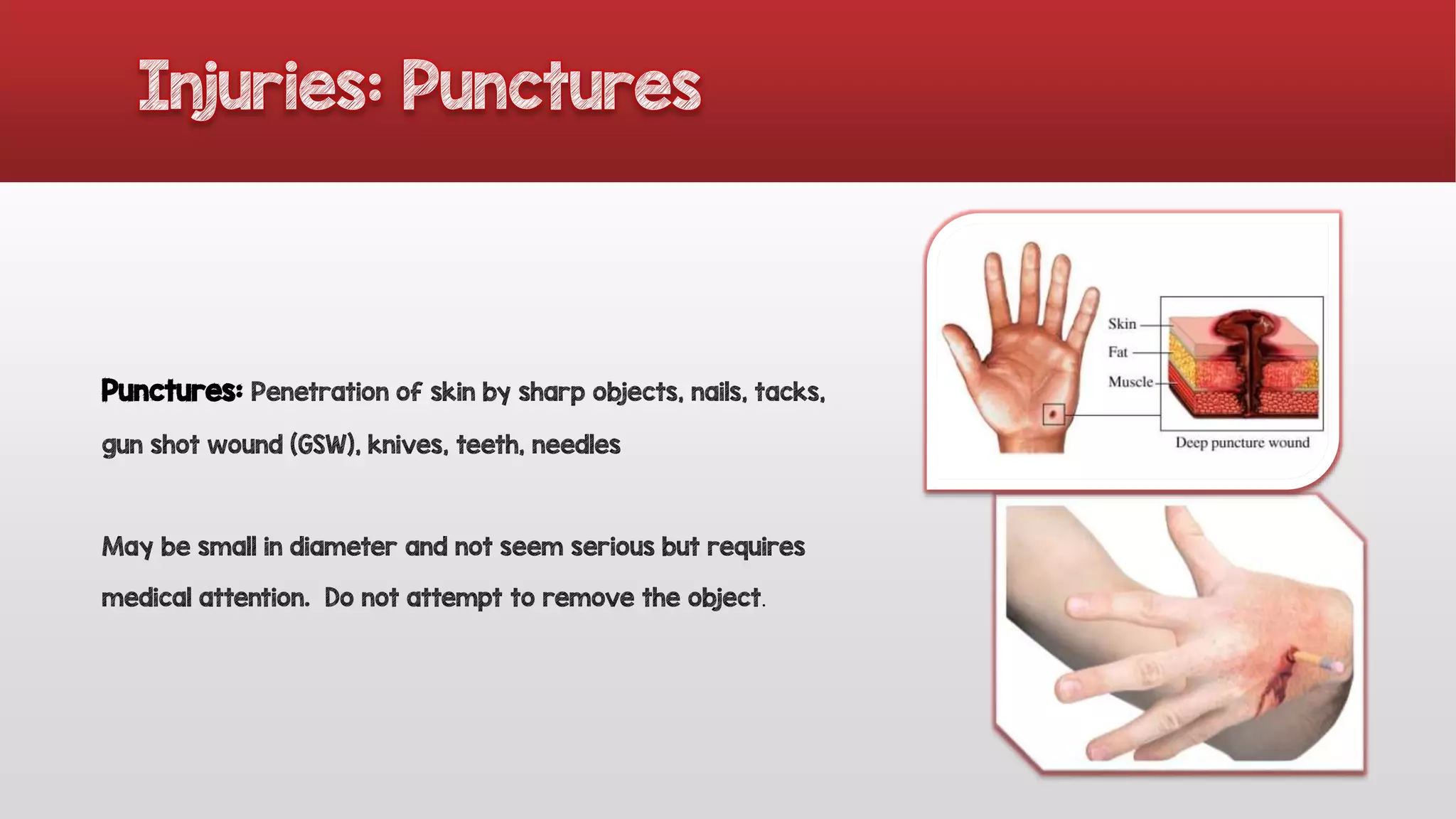 Self aid activity | PPTX