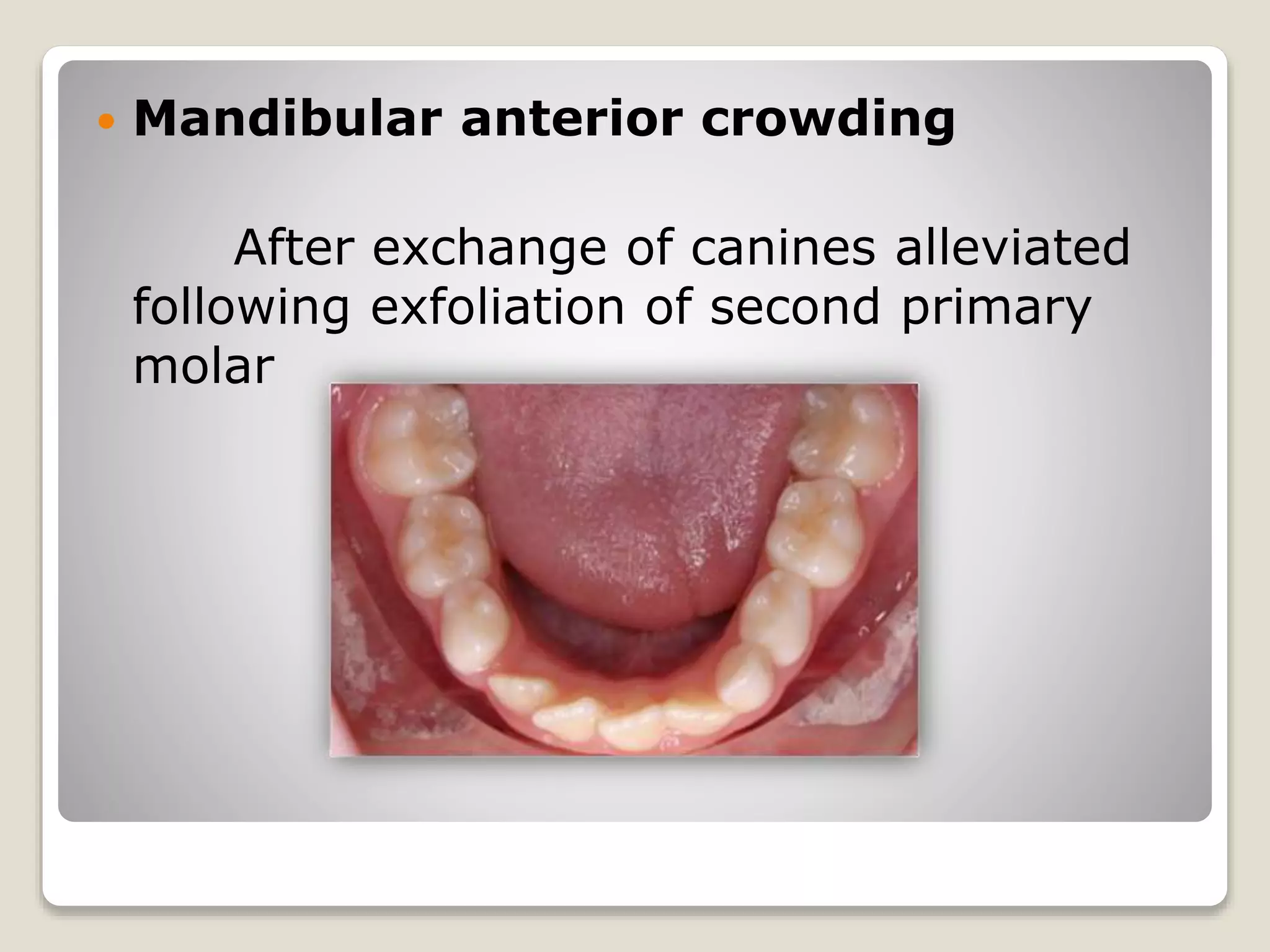 Self correcting anomalies | PPTX