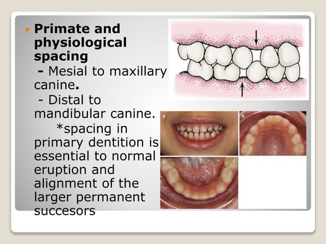 Self correcting anomalies | PPTX