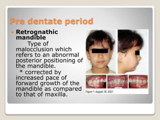 Self correcting anomalies | PPTX