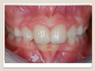 Self correcting anomalies | PPTX