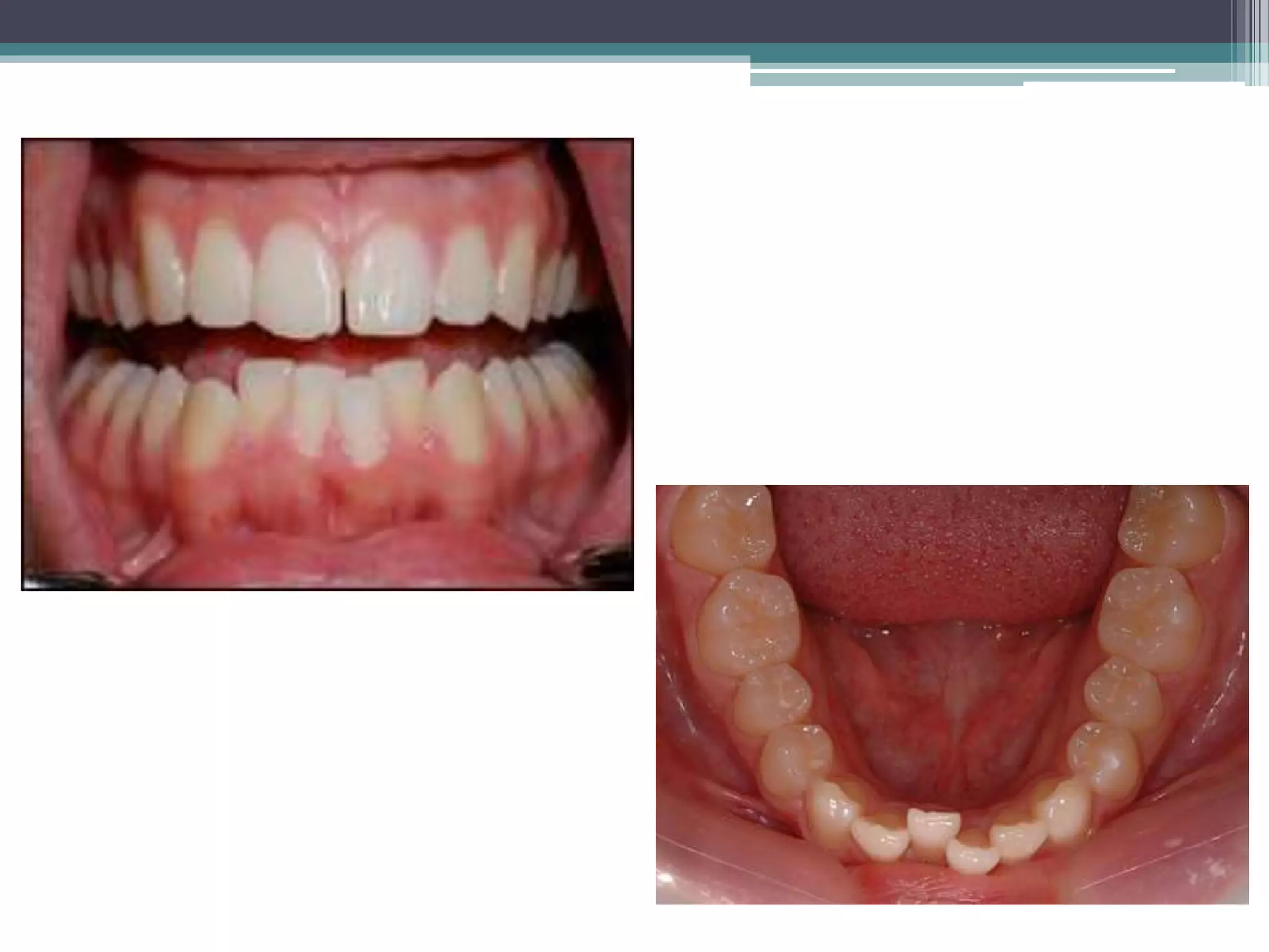 Self correcting anomalies | PPTX
