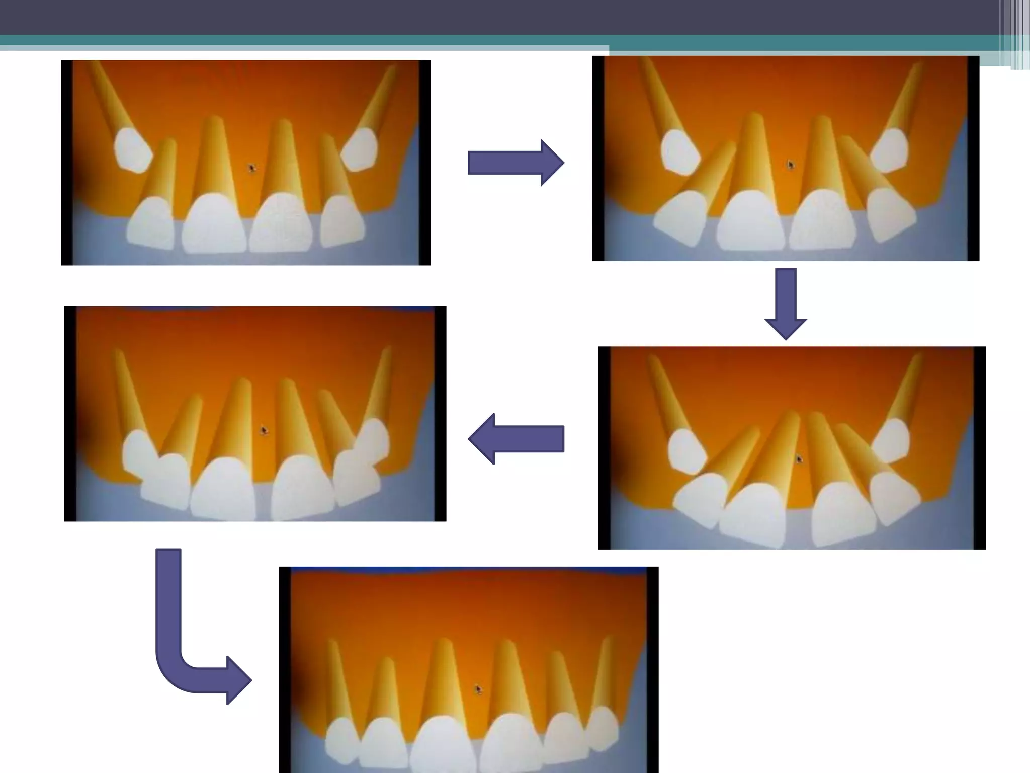 Self correcting anomalies | PPTX