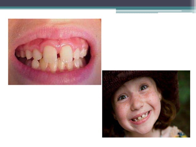 Self correcting anomalies | PPTX