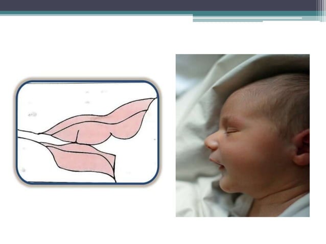 Self correcting anomalies | PPTX