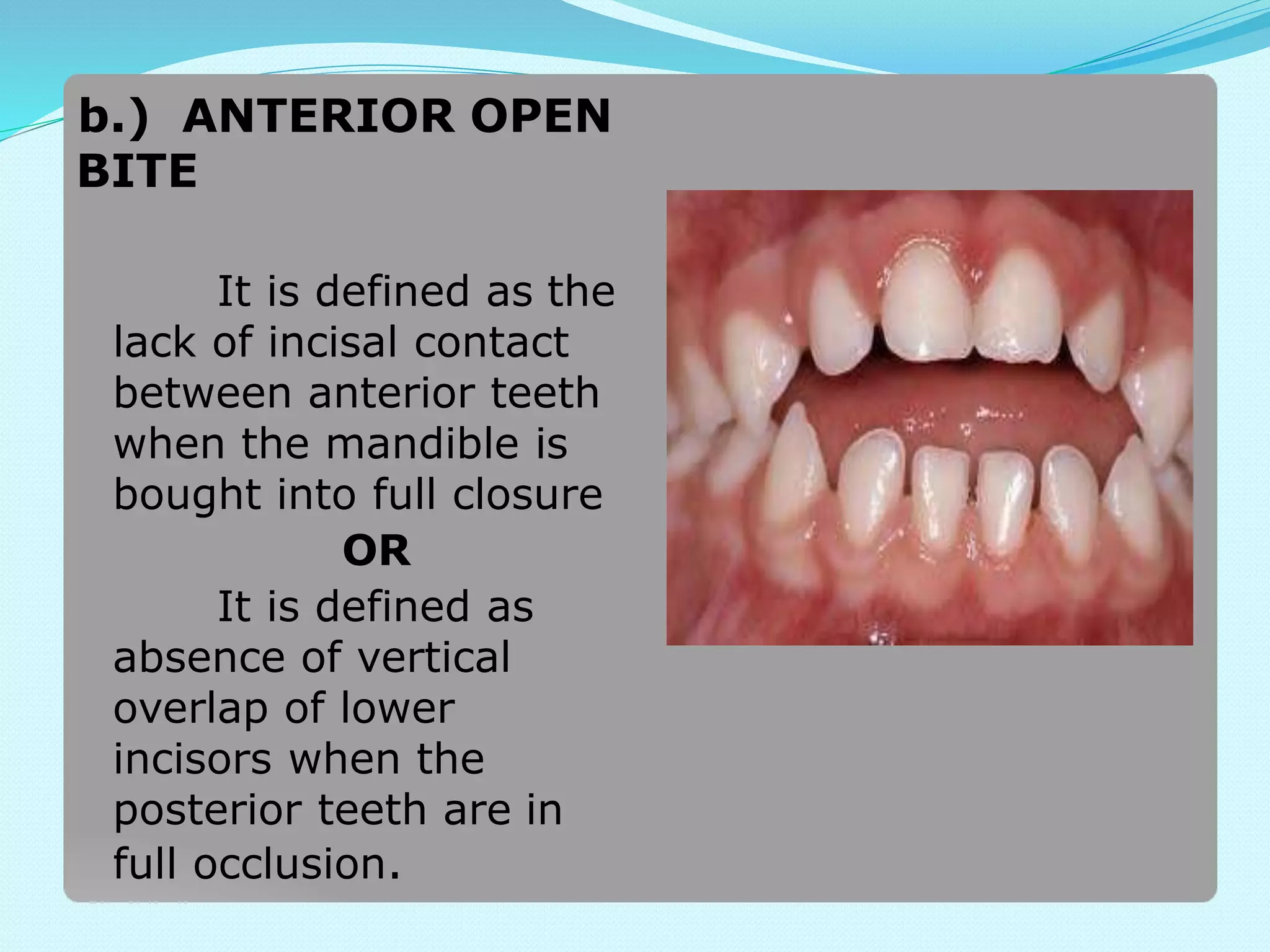 Self correcting anomalies vibhor ortho | PPTX