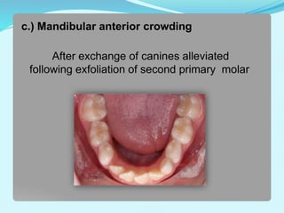 Self correcting anomalies vibhor ortho | PPTX
