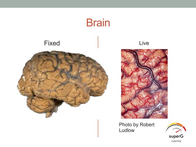 Neuroscience of Self Change | PDF | Brain and Nervous System Disorders ...
