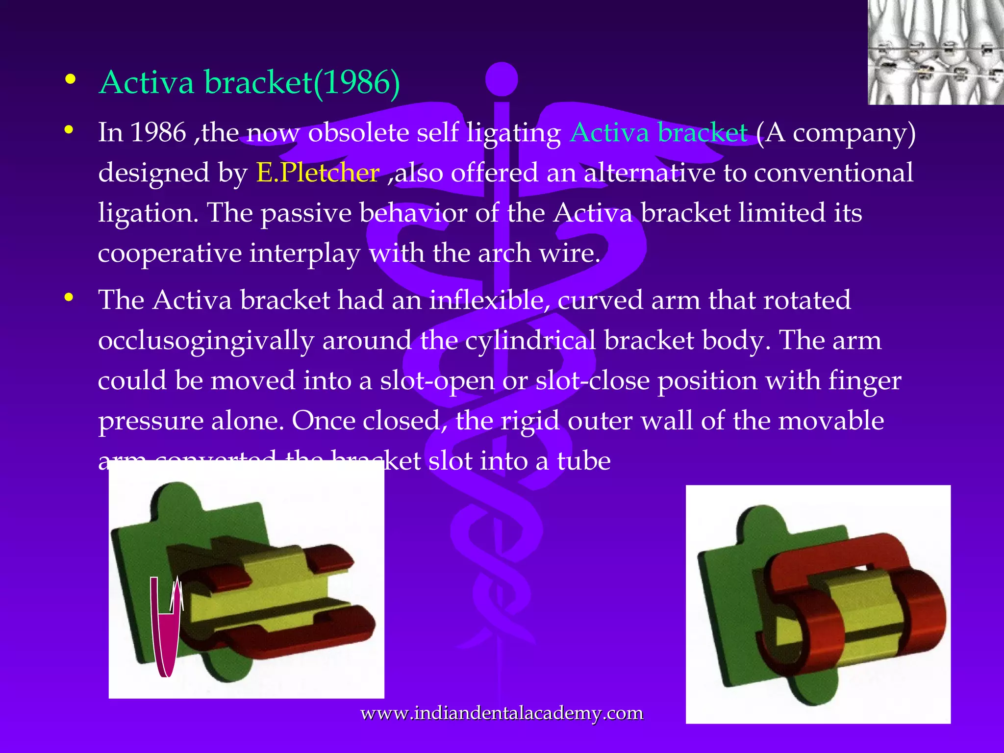 Self ligating brackets | PPT