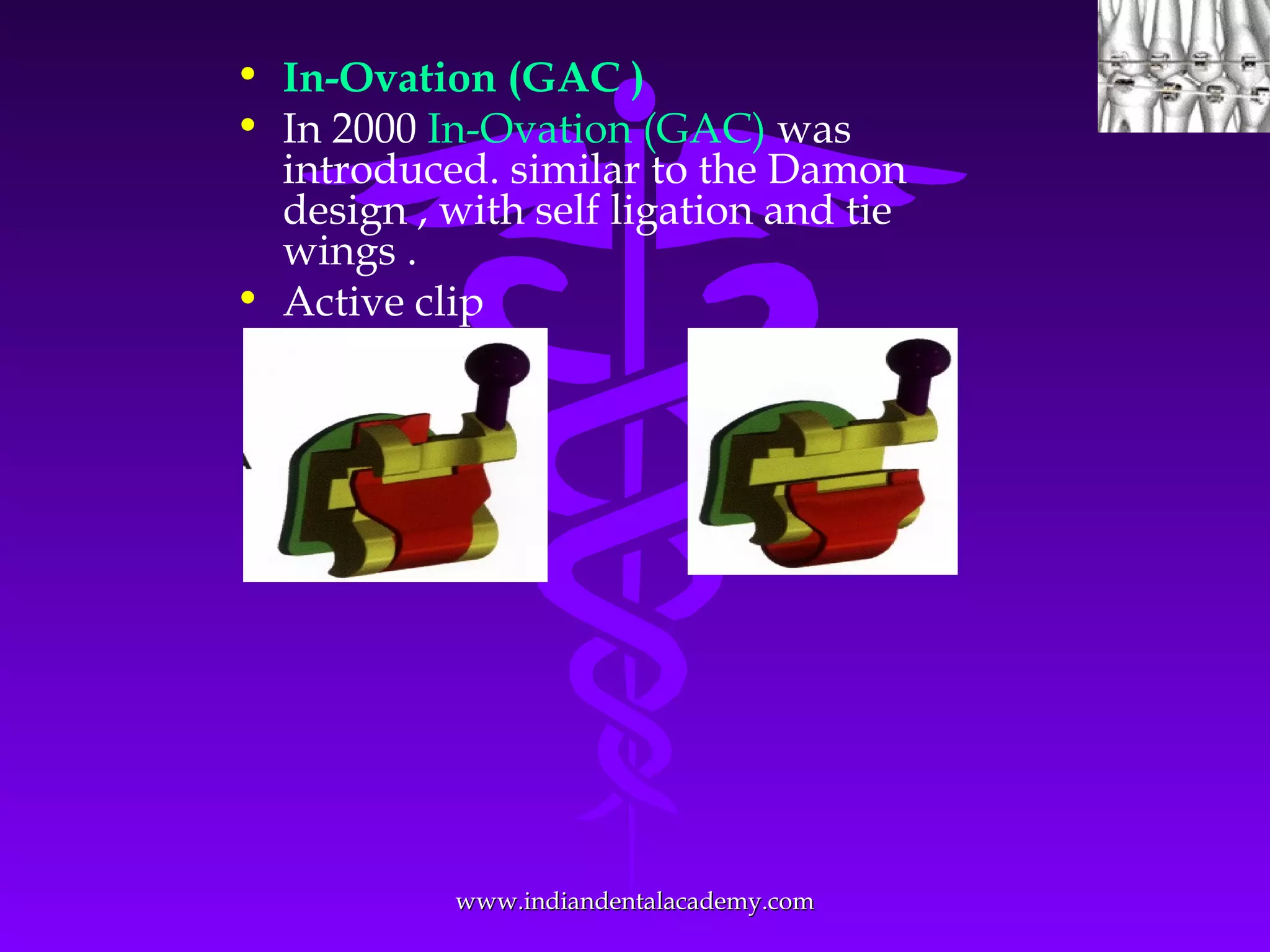 Self ligating brackets | PPT