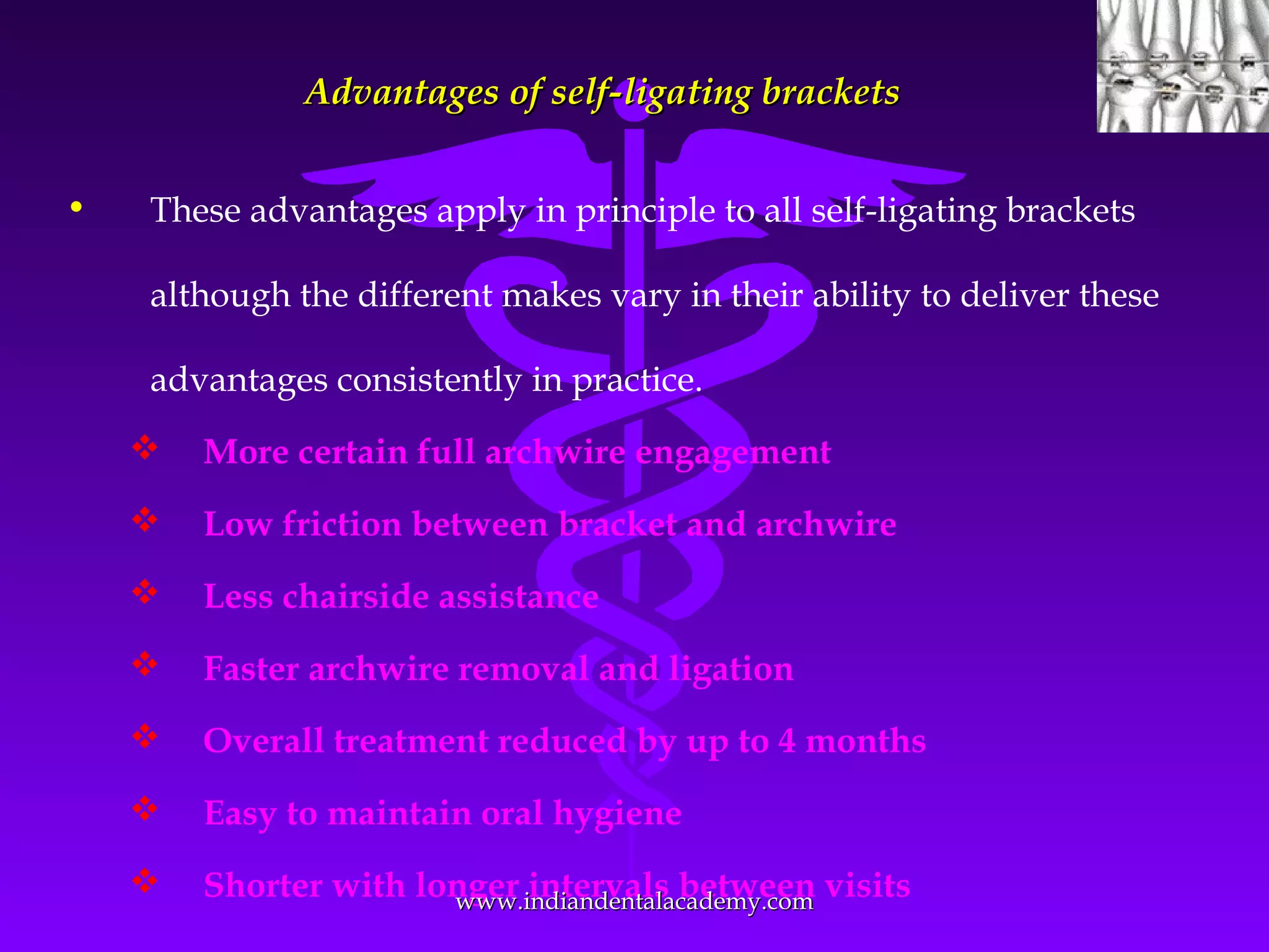 Self ligating brackets | PPT