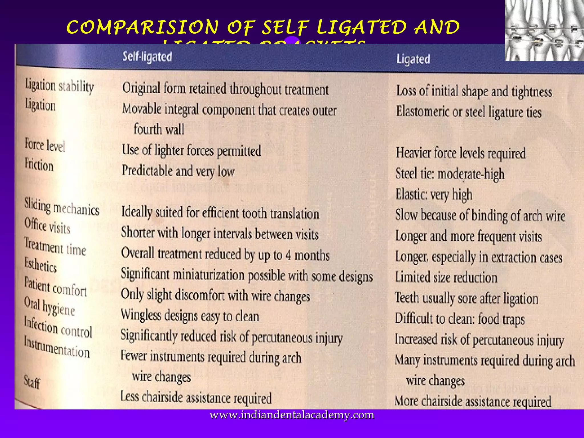 Self ligating brackets | PPT