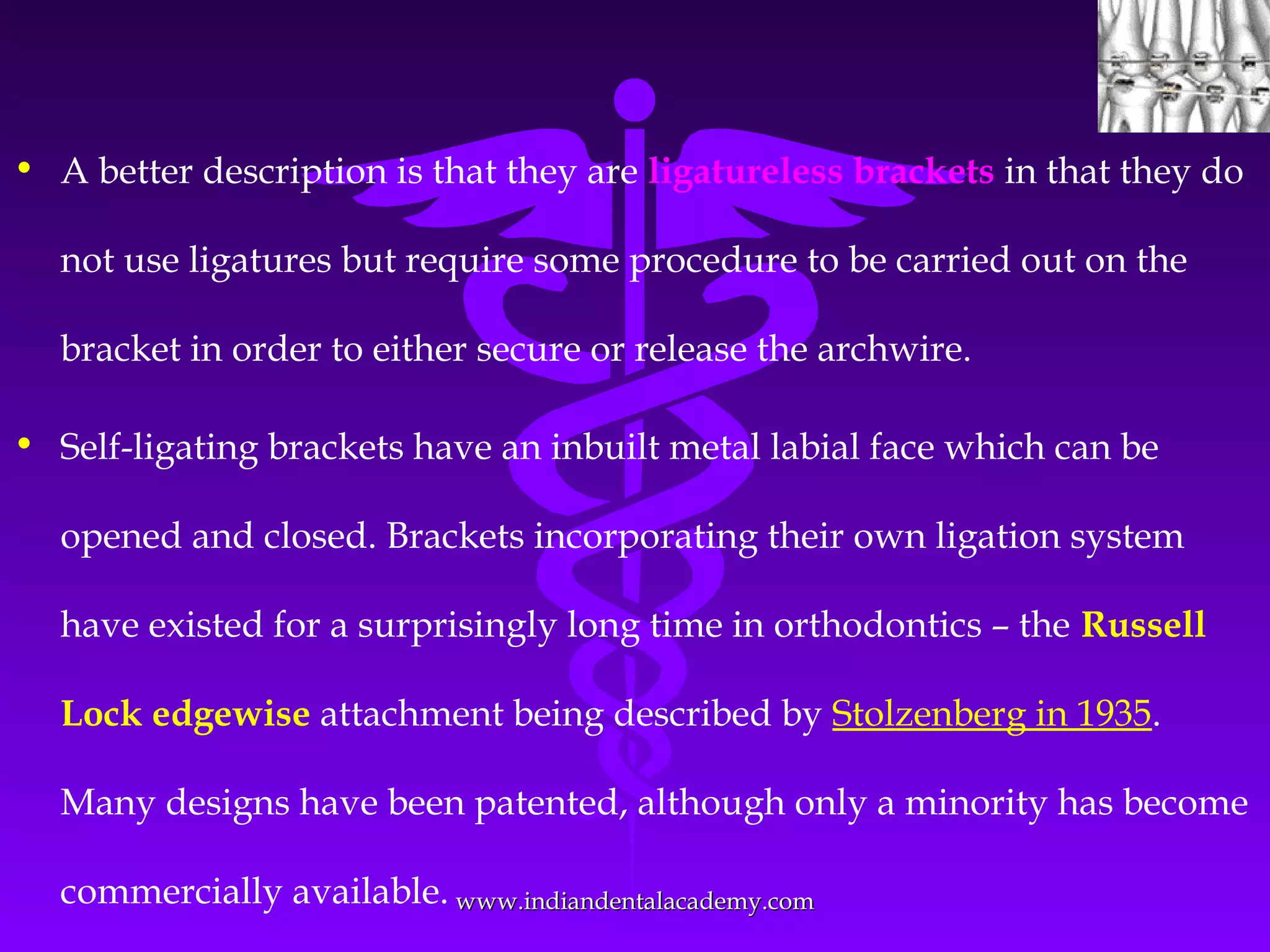 Self ligating brackets | PPT