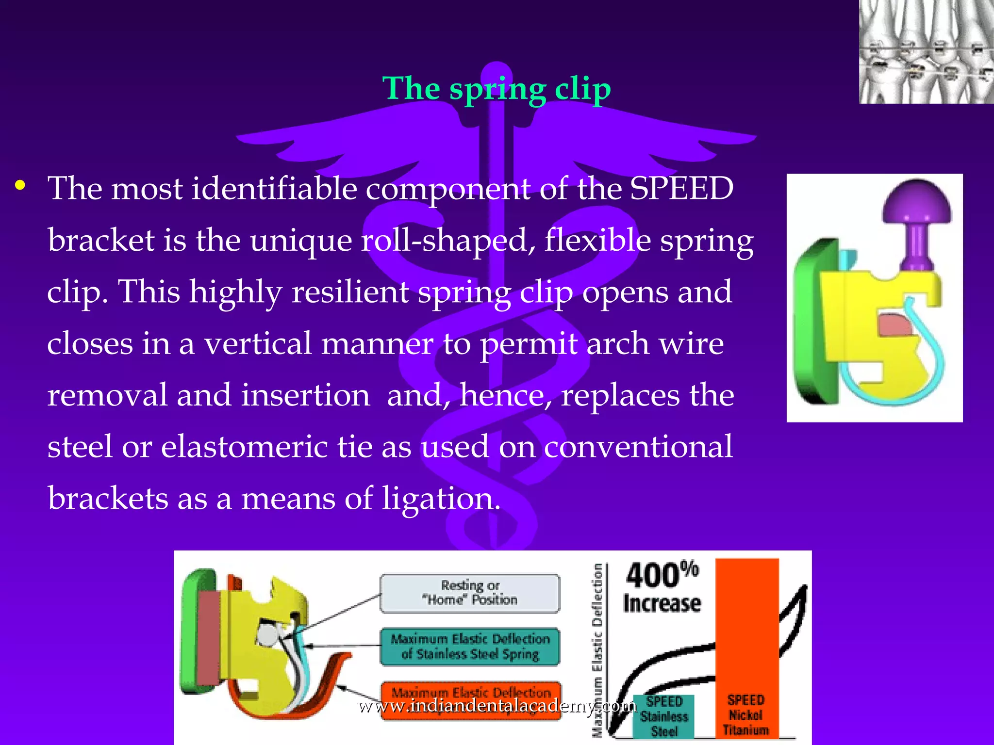 Self ligating brackets | PPT