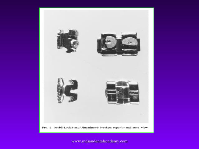 Self ligating brackets | PPT | Oral care | Personal Care