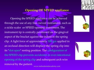 Self ligating brackets | PPT