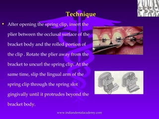 Self ligating brackets | PPT