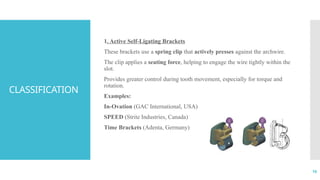 Self ligating Bracket System.pptx................ | PPTX