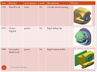 Recent advances inSelf ligating brackets | PDF