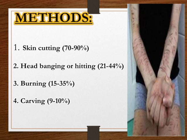 Self mutilation | PPT
