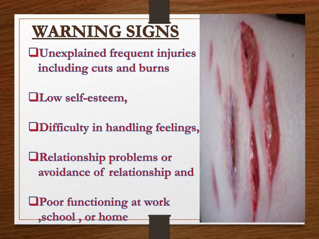 Self mutilation | PPT