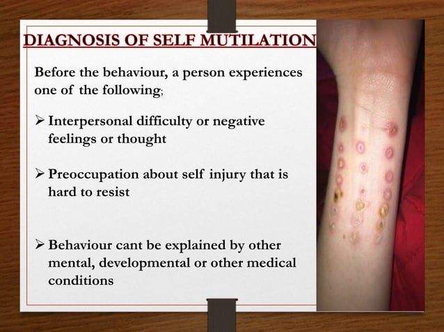 Self mutilation | PPT