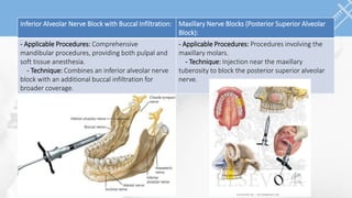 local anesthesia in dentistry terms and indications | PPT