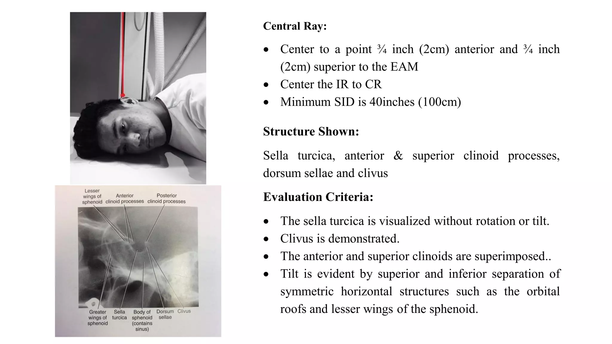 Sella Turcica (RAD31) | PDF