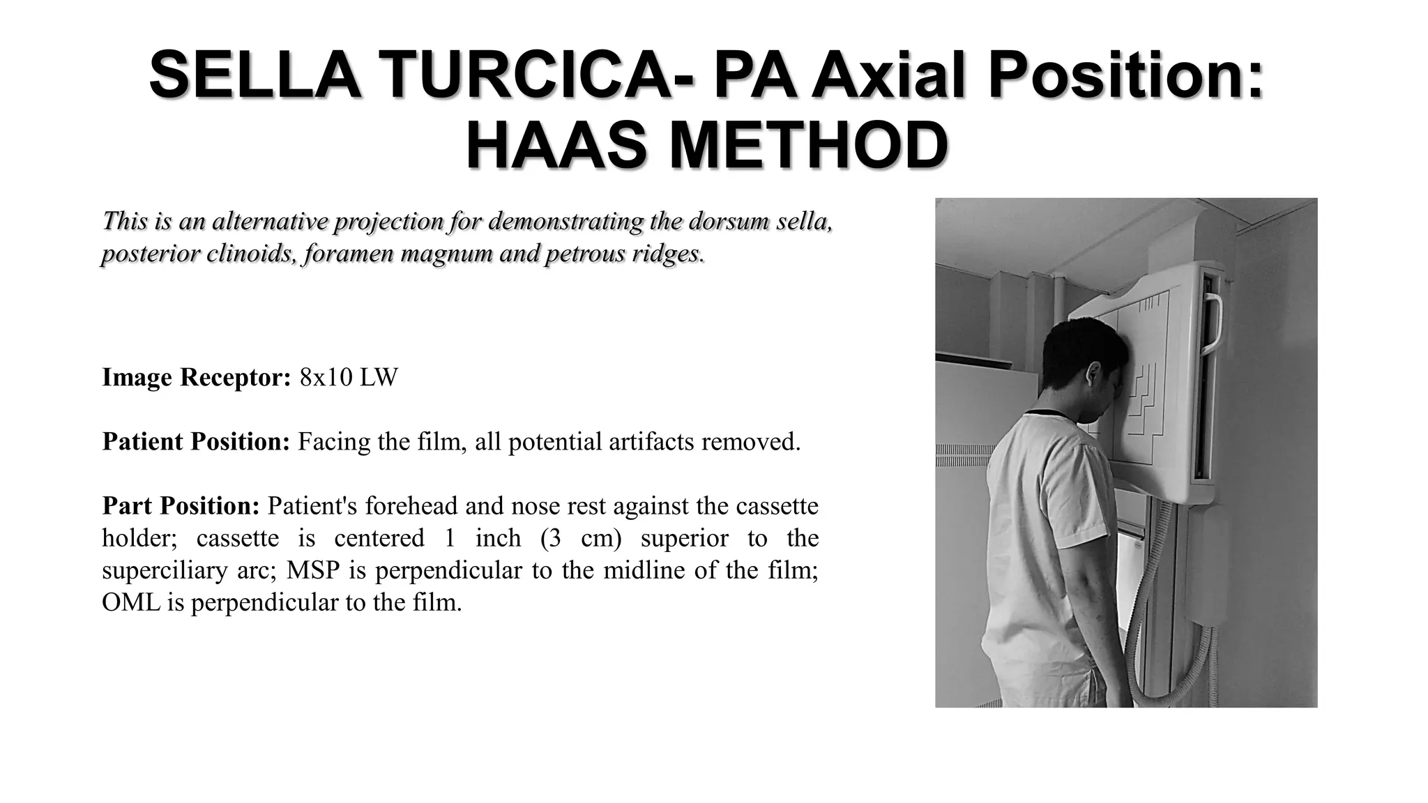 Sella Turcica (RAD31) | PDF