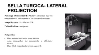 Sella Turcica (RAD31) | PDF