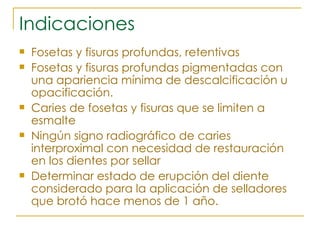 Selladores de fosetas y fisuras | PPS | Oral care | Personal Care