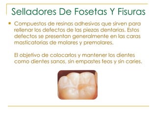 Selladores de fosetas y fisuras | PPS