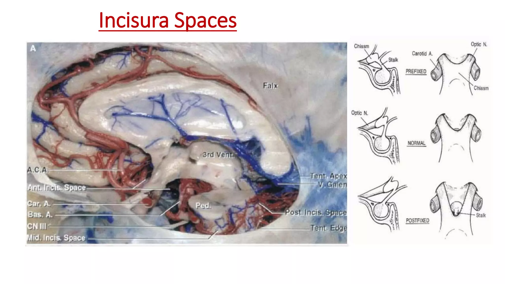 Sellar anatomy copy | PPT | Free Download