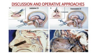 Sellar anatomy copy | PPT