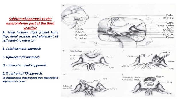 Sellar anatomy copy | PPT | Free Download