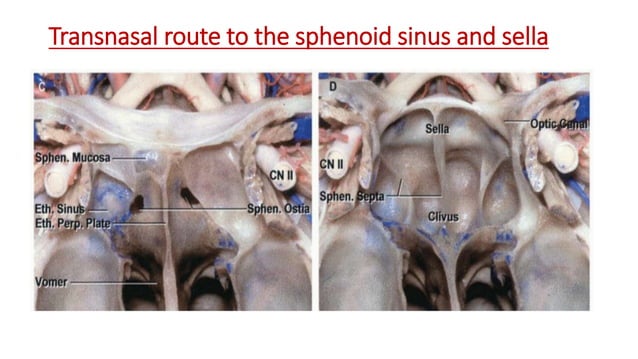 Sellar anatomy copy | PPT | Free Download