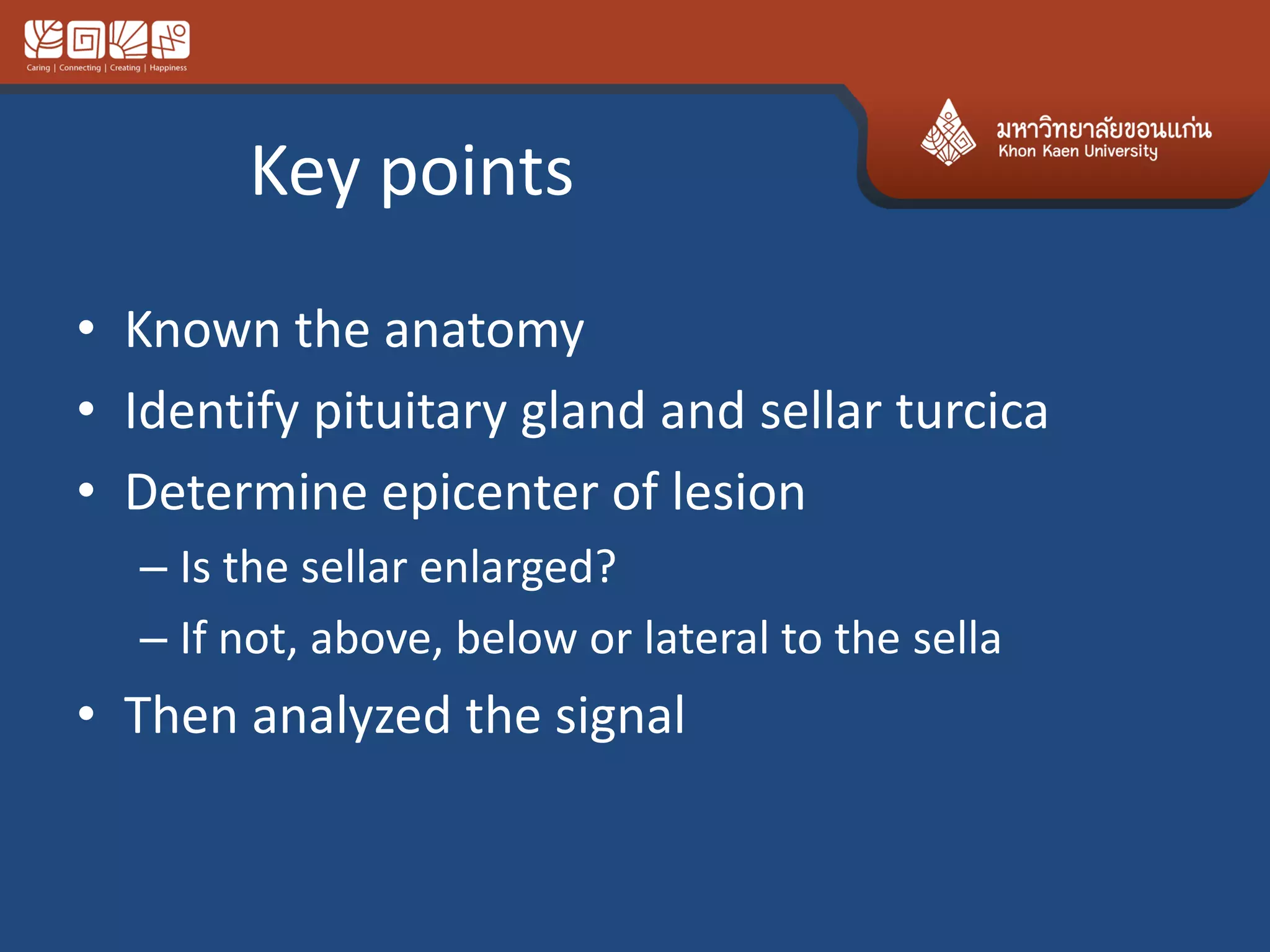 Sellar and parasellar tumor | PDF