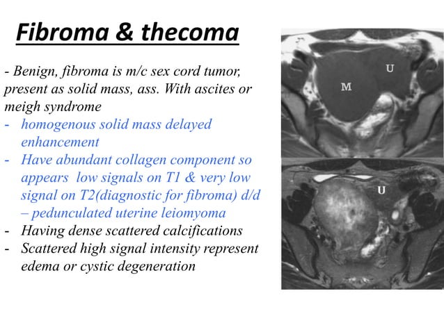 Sellar mass and ovarian mass | PPT